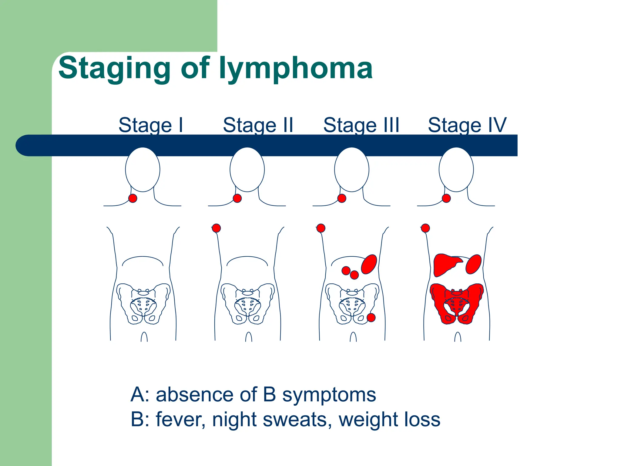 Diagnosis and examination of swollen lymph nodes ppt.pptx | Cancer ...