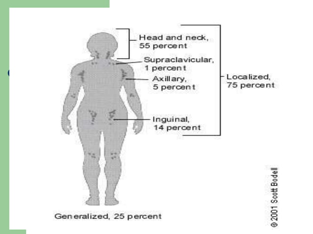 Diagnosis and examination of swollen lymph nodes ppt.pptx