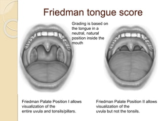 Diagnosis and investigations of Obstructive sleep apnea | PPT