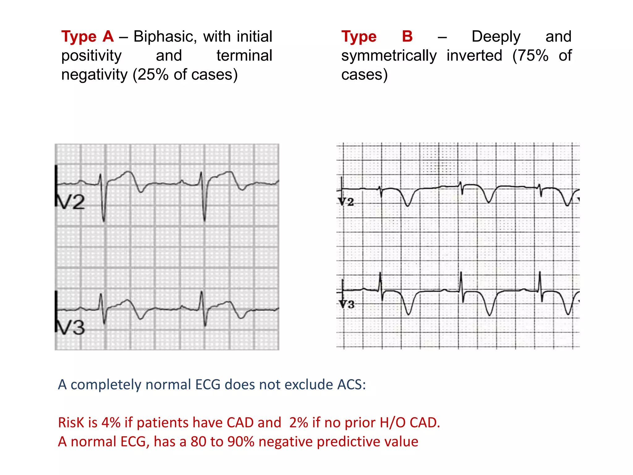 DIAGNOSIS AND MANAGEMENT OF ACS copy.pptx | Heart and Cardiovascular ...