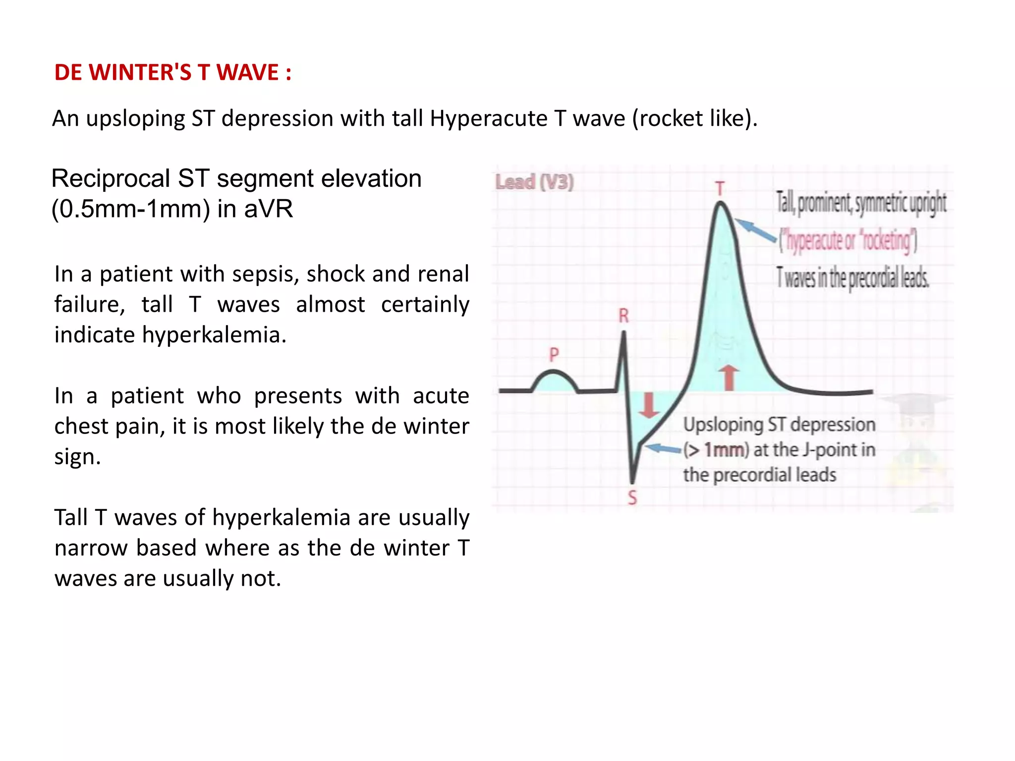DIAGNOSIS AND MANAGEMENT OF ACS copy.pptx | Heart and Cardiovascular ...