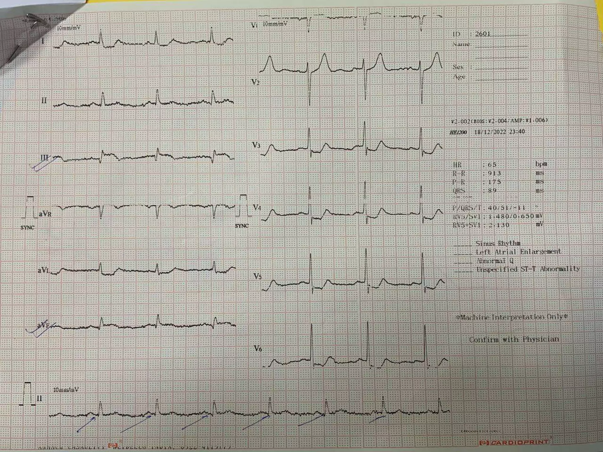 DIAGNOSIS AND MANAGEMENT OF ACS copy.pptx | Heart and Cardiovascular ...
