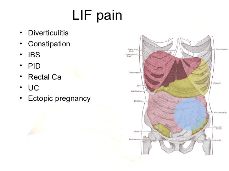 Diagnosis And Management Of Acute Abdominalpain