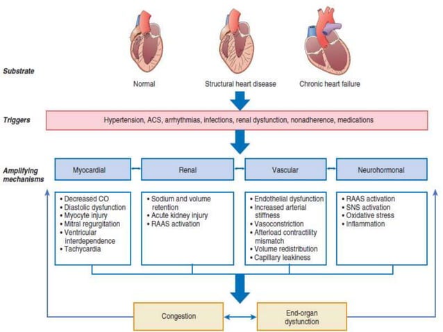 Diagnosis and management of acute heart failure