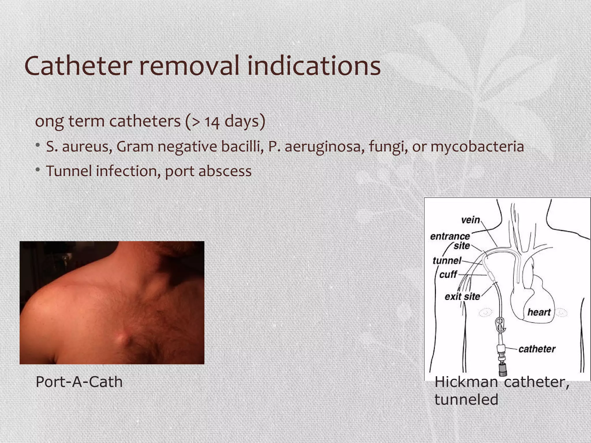 Diagnosis and management of central line infections | PPT