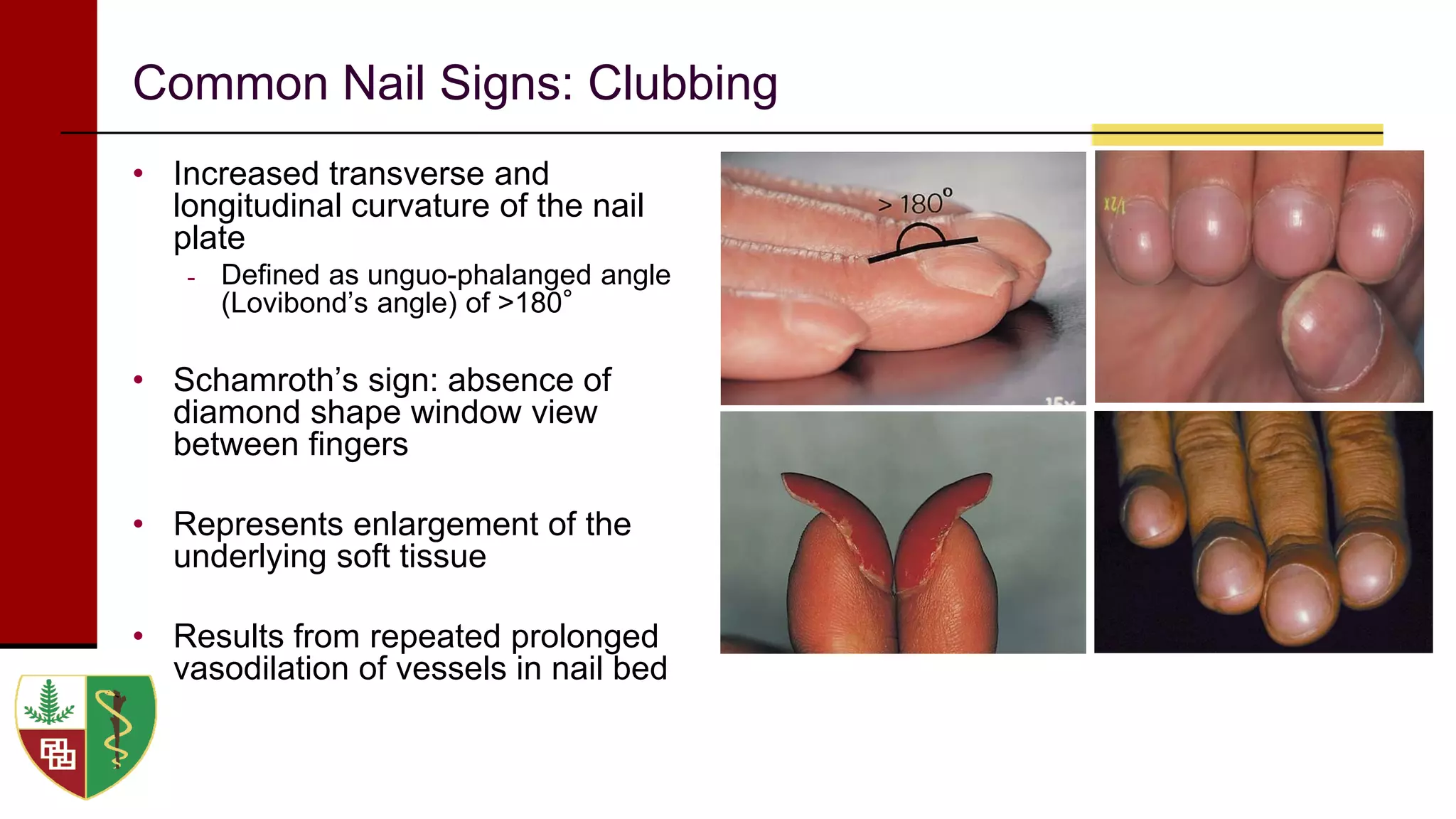diagnosis_and_management_of_common_nail_disorders_-_yost.pdf