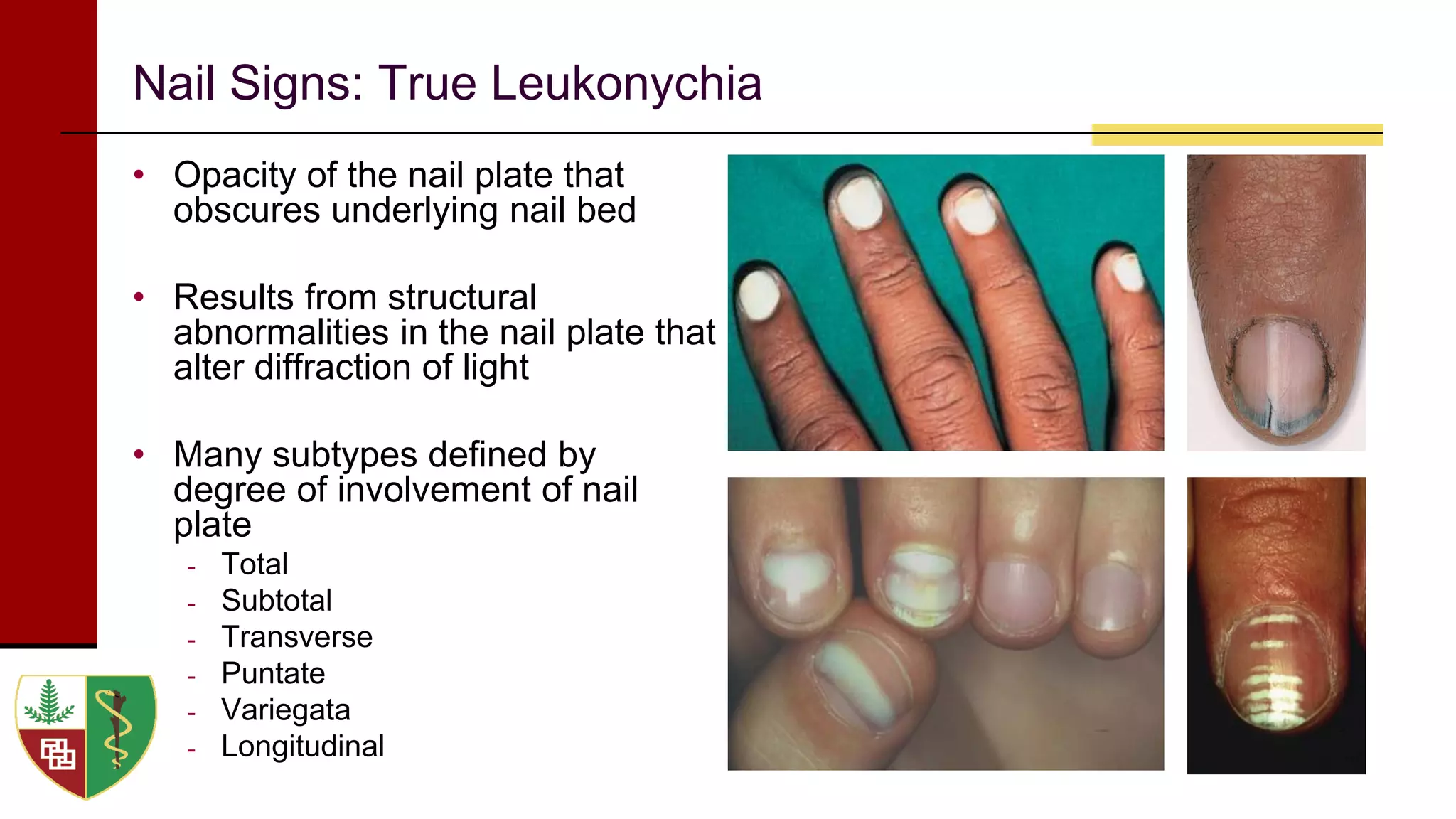 diagnosis_and_management_of_common_nail_disorders_-_yost.pdf