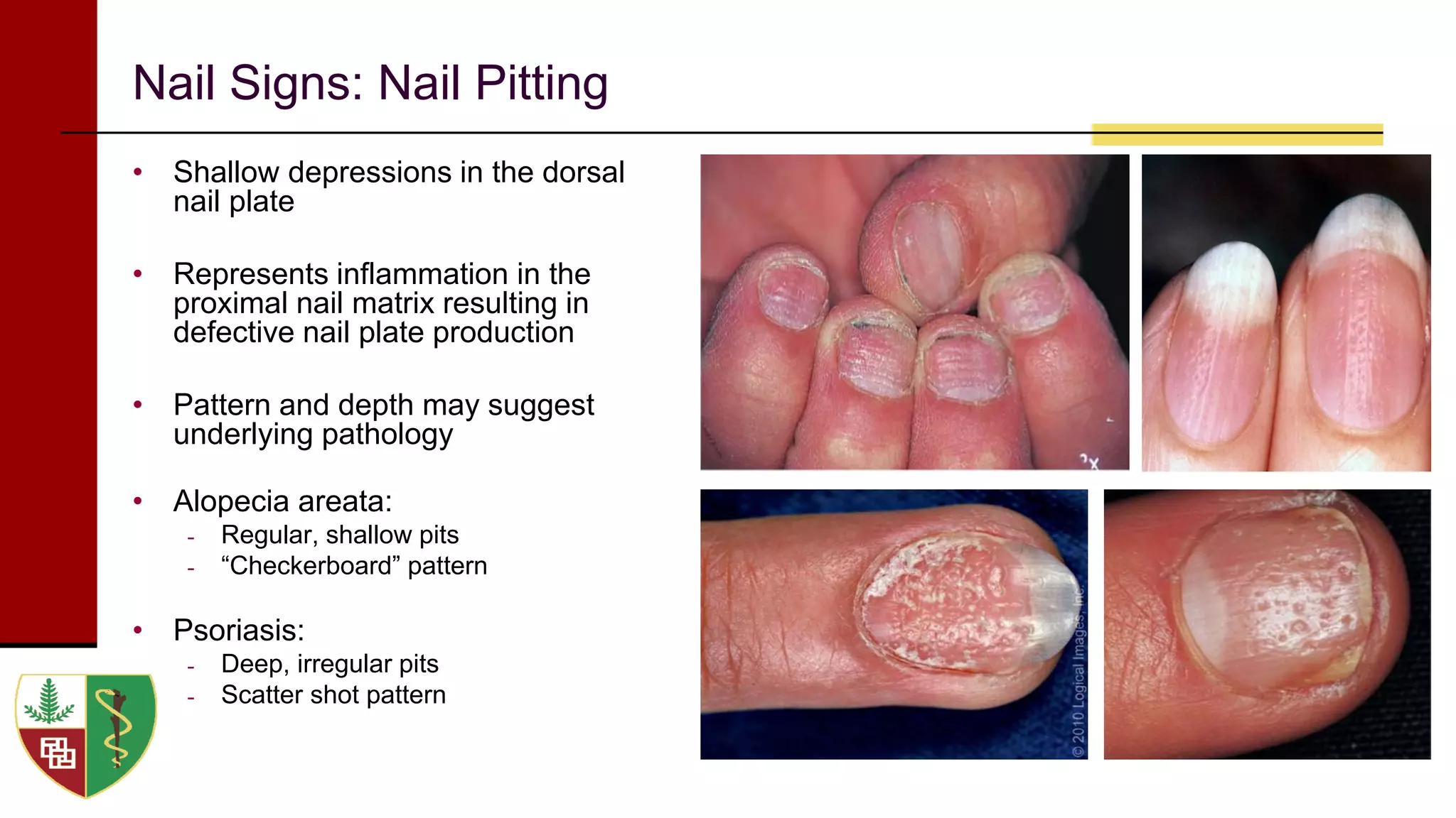 diagnosis_and_management_of_common_nail_disorders_-_yost.pdf