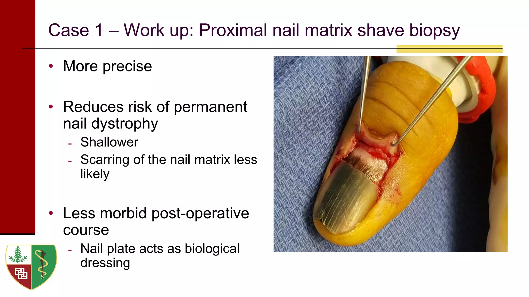 diagnosis_and_management_of_common_nail_disorders_-_yost.pdf