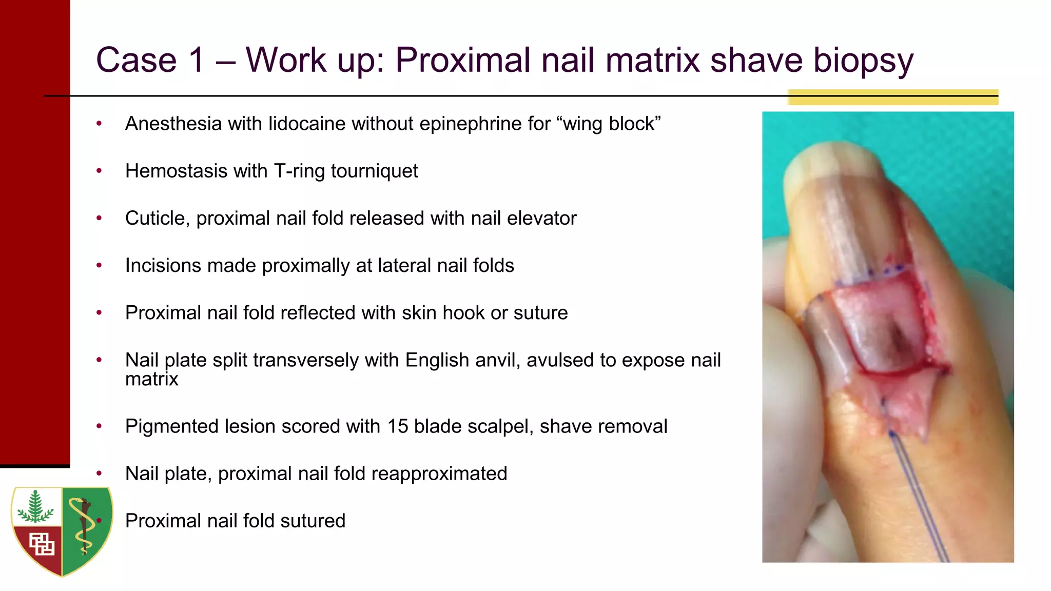 diagnosis_and_management_of_common_nail_disorders_-_yost.pdf