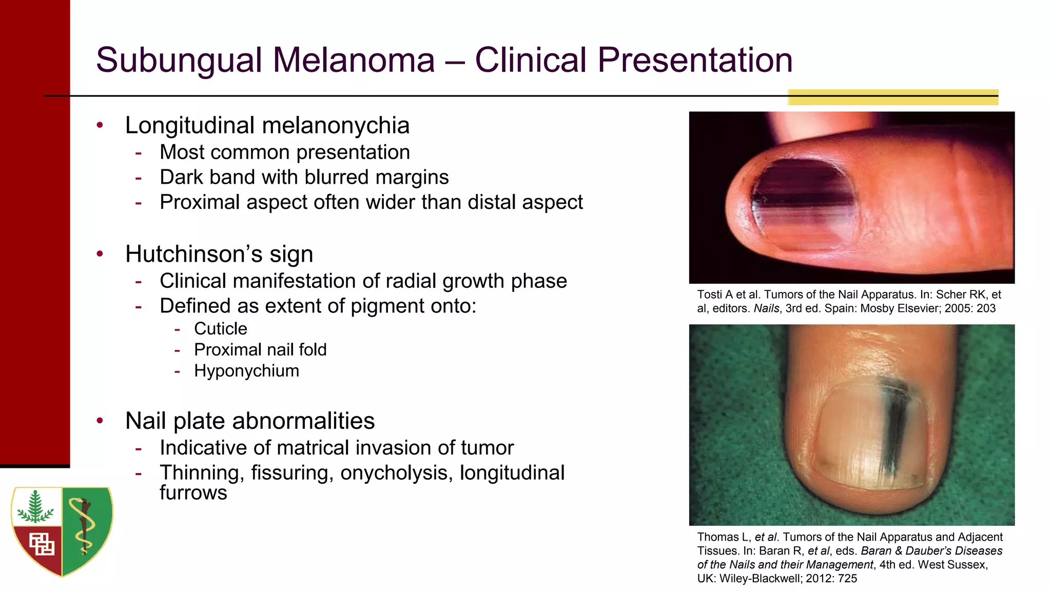 diagnosis_and_management_of_common_nail_disorders_-_yost.pdf