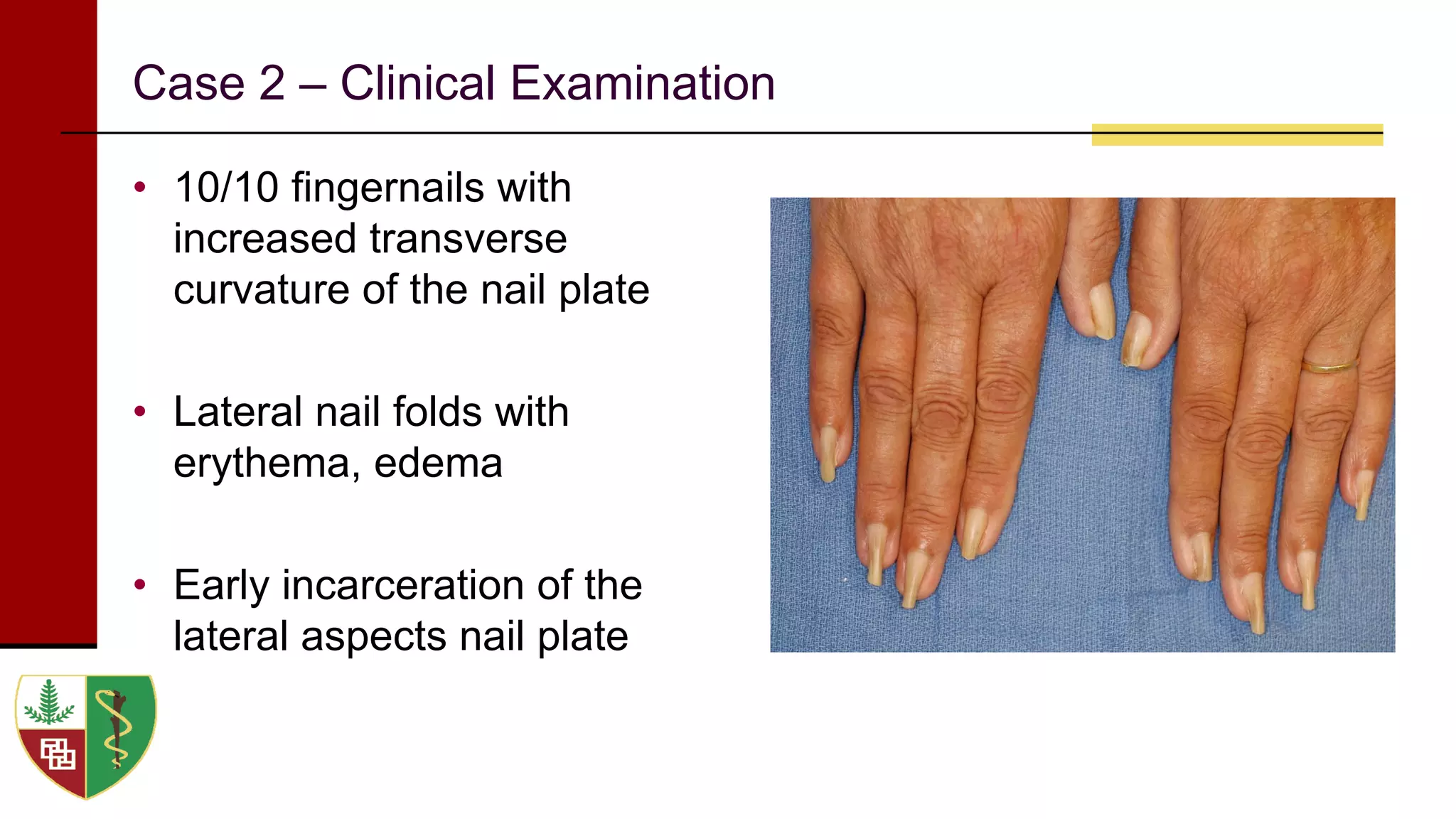 diagnosis_and_management_of_common_nail_disorders_-_yost.pdf