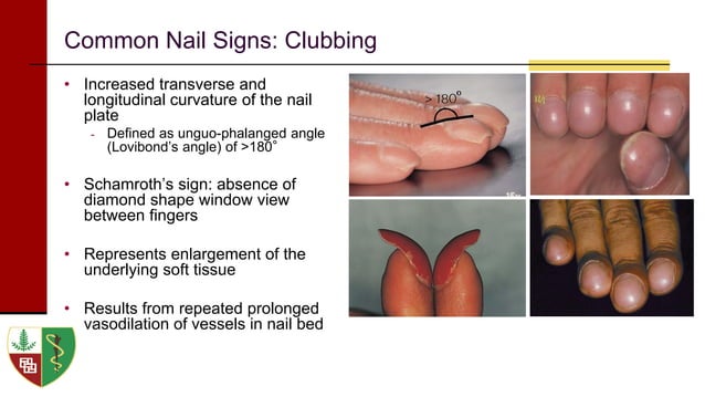 diagnosis_and_management_of_common_nail_disorders_-_yost.pdf