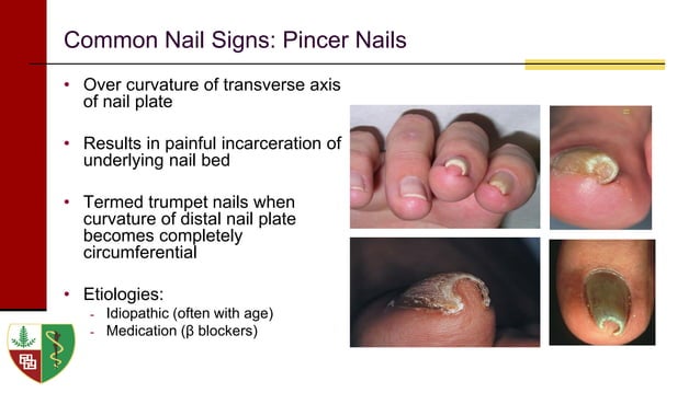 diagnosis_and_management_of_common_nail_disorders_-_yost.pdf