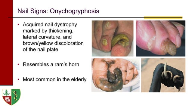diagnosis_and_management_of_common_nail_disorders_-_yost.pdf