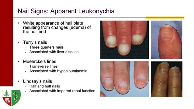 diagnosis_and_management_of_common_nail_disorders_-_yost.pdf