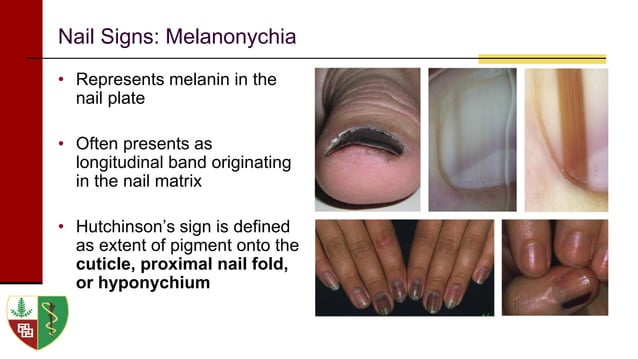 diagnosis_and_management_of_common_nail_disorders_-_yost.pdf