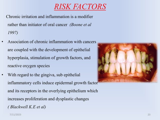 DIAGNOSIS AND MANAGEMENT OF GINGIVAL TUMORS final.ppt