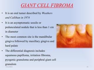 DIAGNOSIS AND MANAGEMENT OF GINGIVAL TUMORS final.ppt