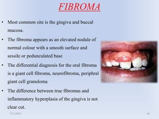 DIAGNOSIS AND MANAGEMENT OF GINGIVAL TUMORS final.ppt