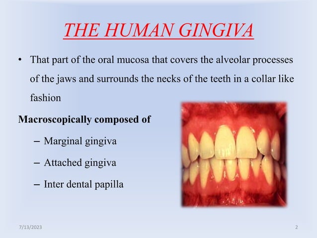 DIAGNOSIS AND MANAGEMENT OF GINGIVAL TUMORS final.ppt