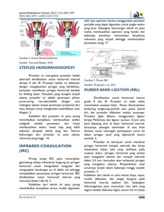 Diagnosis_and_Management_of_Hemorrhoids.pdf