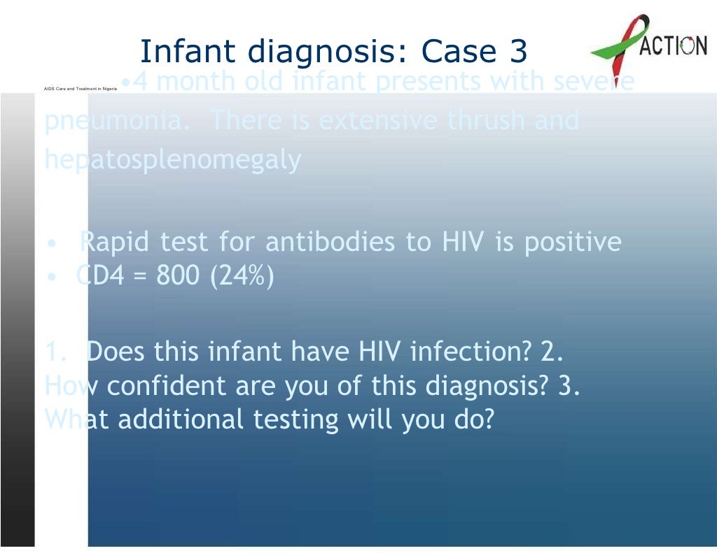 Diagnosis and management_of_hiv_exposed_infant
