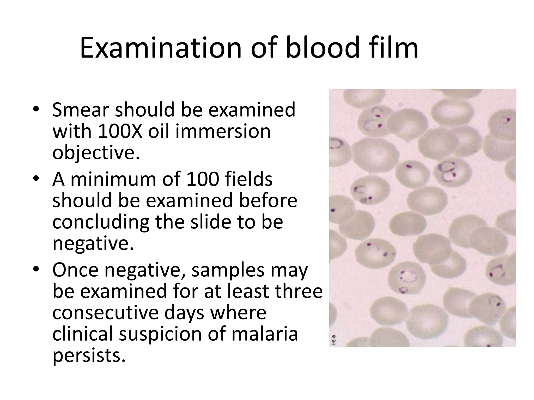 Diagnosis and Management of malaria in children | PPTX