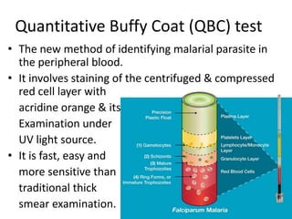 Diagnosis and Management of malaria in children | PPTX