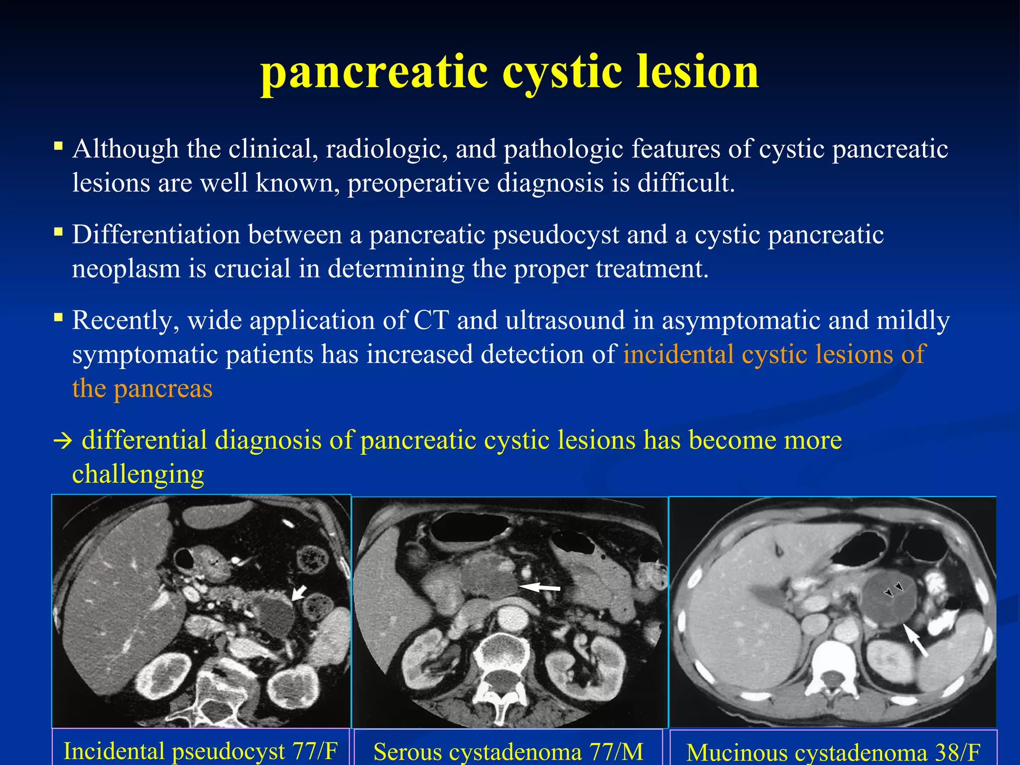 Diagnosis And Management Of Pancreatic Cystic Lesion | PPT