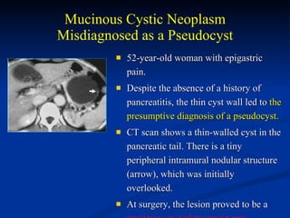 Diagnosis And Management Of Pancreatic Cystic Lesion | PPT