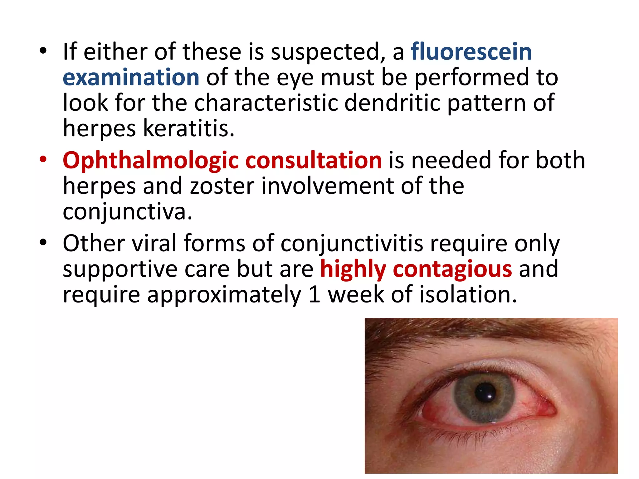 Diagnosis and management of pediatric conjunctivitis | PPTX