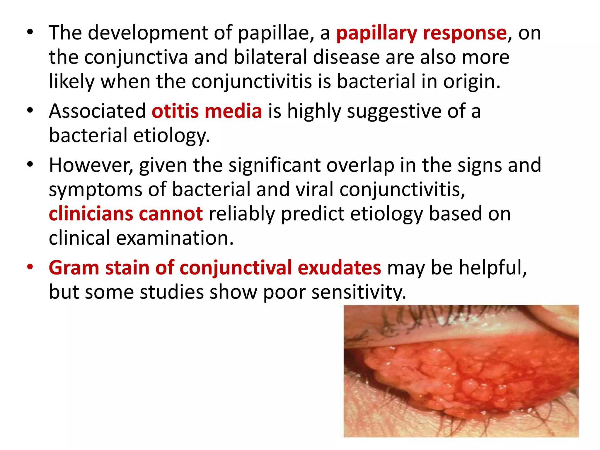 Diagnosis and management of pediatric conjunctivitis | PPTX