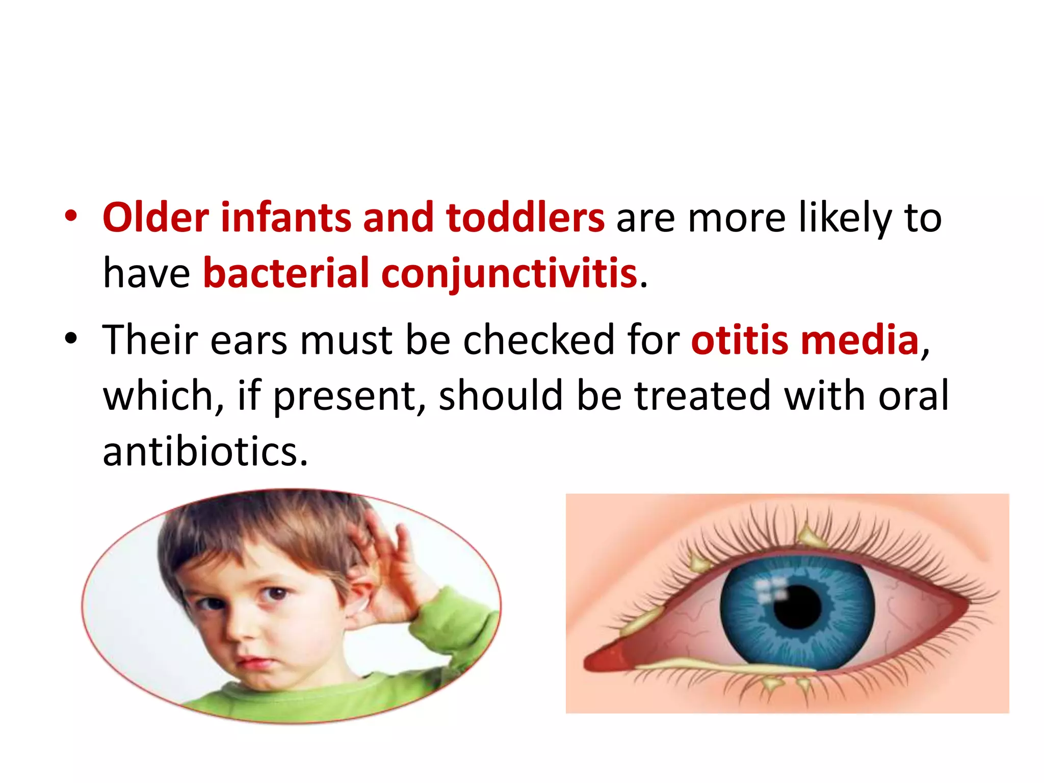 Diagnosis and management of pediatric conjunctivitis | PPTX