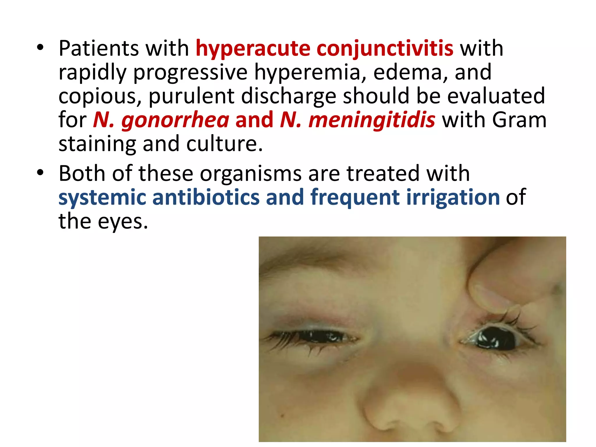 Diagnosis and management of pediatric conjunctivitis | PPTX