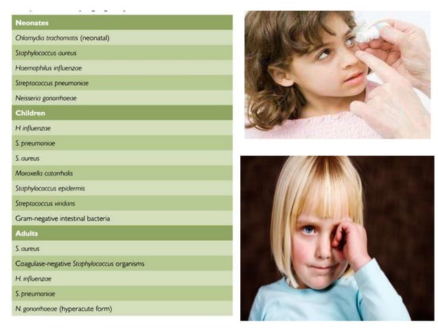 Diagnosis and management of pediatric conjunctivitis | PPTX | Ear, Nose ...
