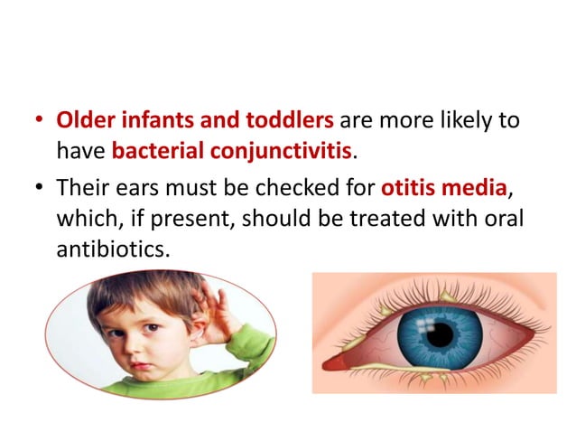 Diagnosis and management of pediatric conjunctivitis | PPTX | Ear, Nose ...