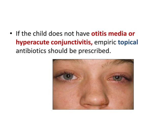 Diagnosis and management of pediatric conjunctivitis | PPTX | Ear, Nose ...
