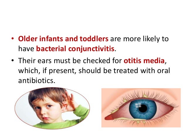 Diagnosis And Management Of Pediatric Conjunctivitis