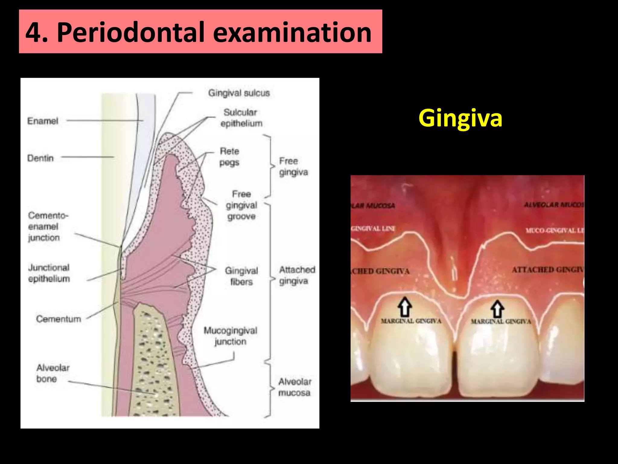 Diagnosis and periodontal consideration in fdp | PPTX