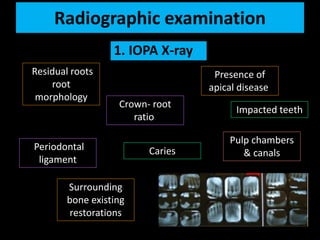 Diagnosis and periodontal consideration in fdp | PPTX
