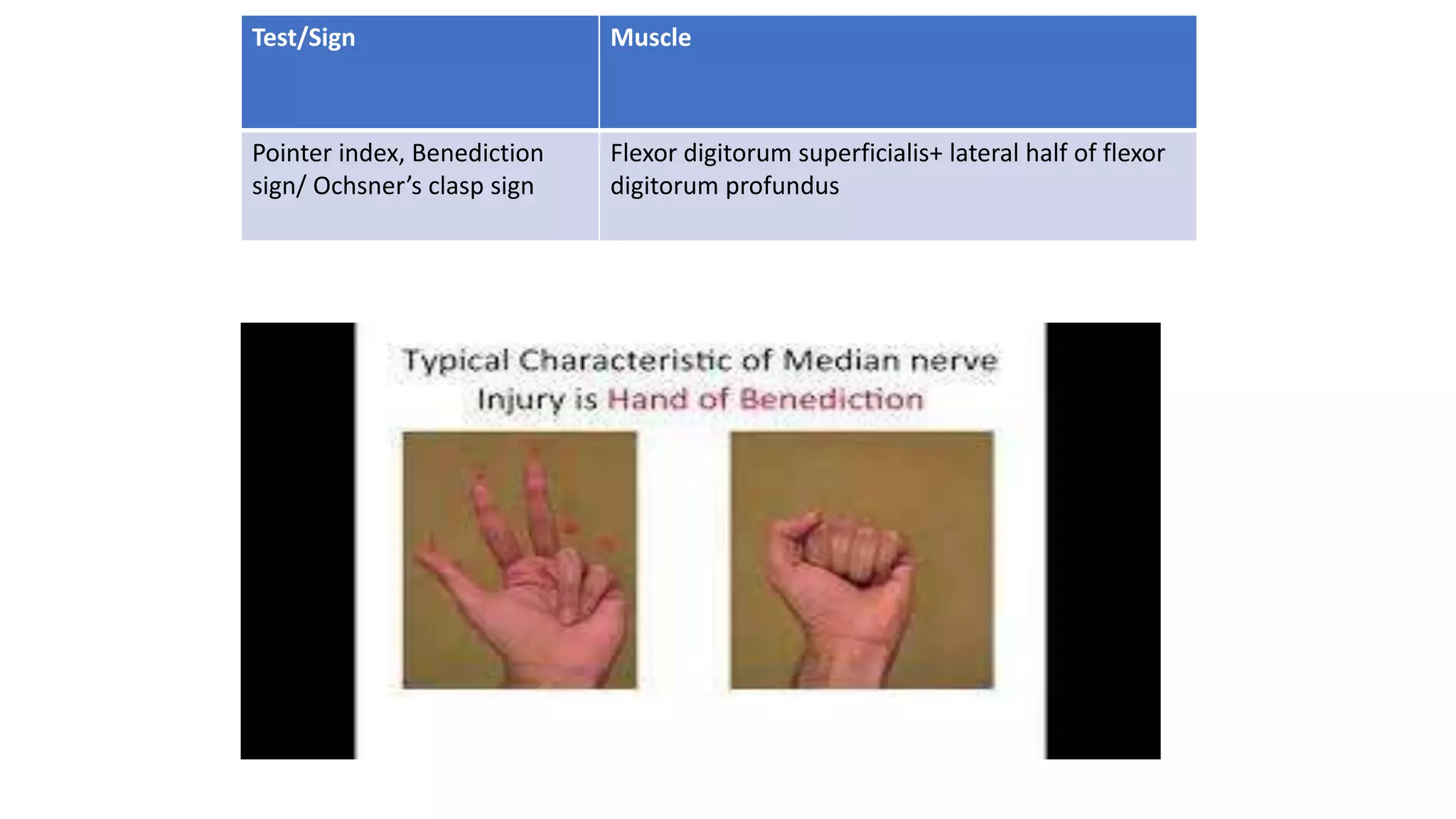 Diagnosis and principles of management of radial^J.pptx