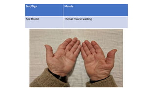 Diagnosis and principles of management of radial^J.pptx