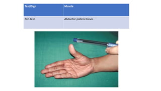 Diagnosis and principles of management of radial^J.pptx