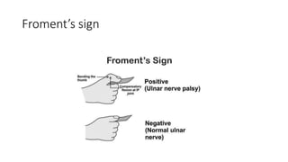 Diagnosis and principles of management of radial^J.pptx