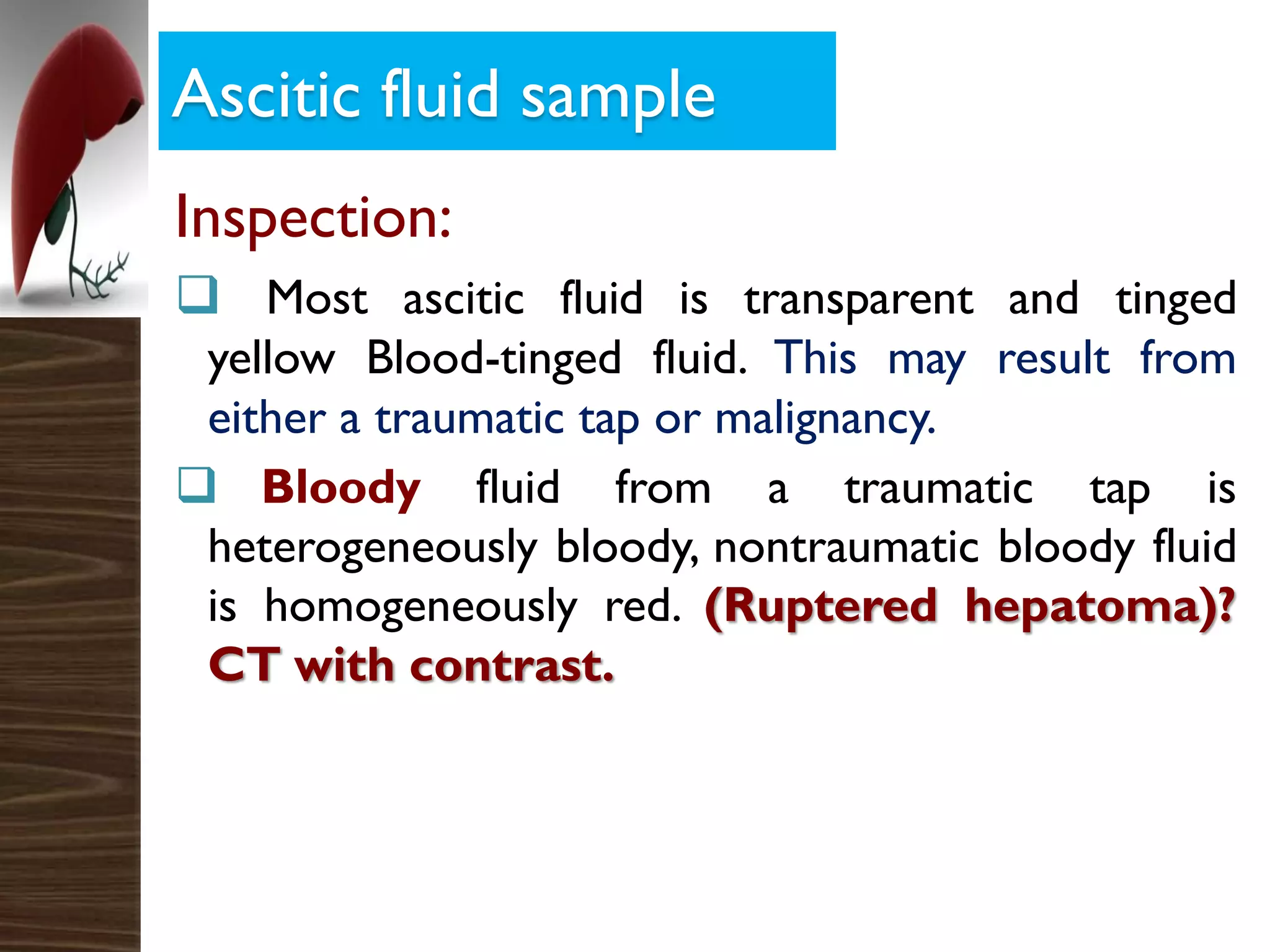 Diagnosis and Treatment of Ascites | PDF