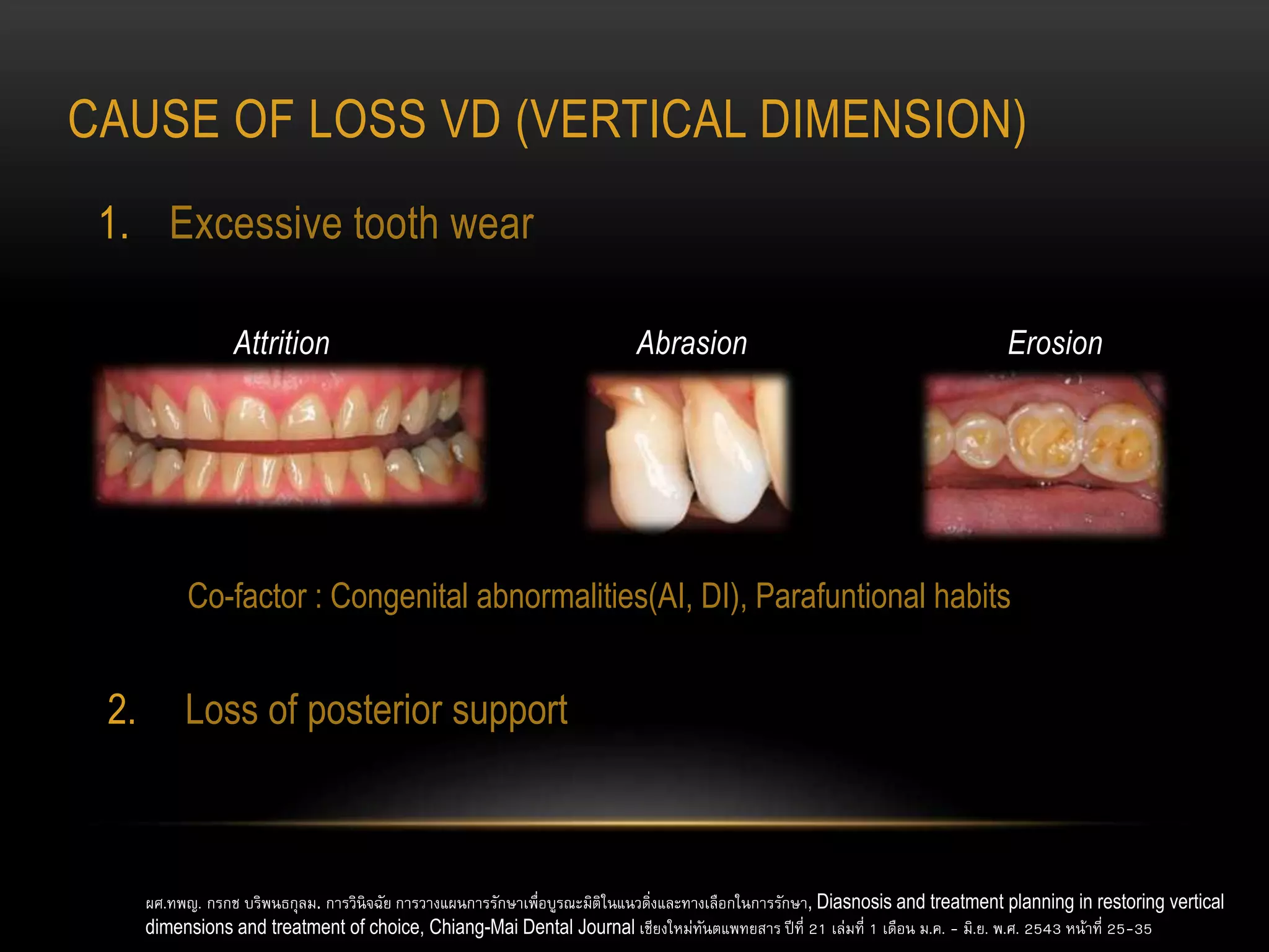 Diagnosis and treatment of choice in restoring vertical dimension | PPTX