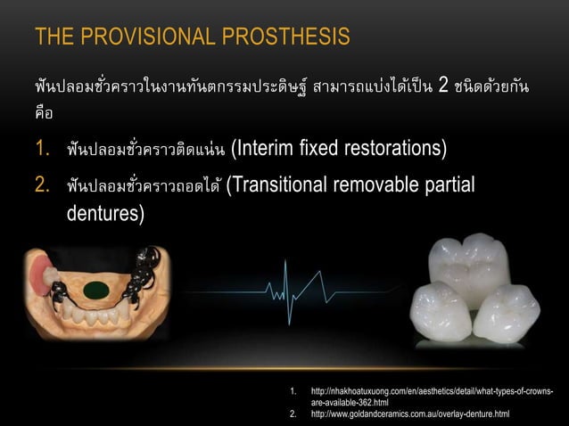 Diagnosis and treatment of choice in restoring vertical dimension | PPTX