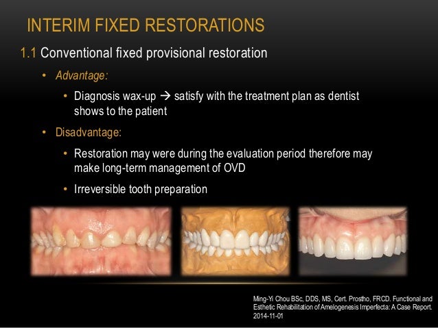 Diagnosis and treatment of choice in restoring vertical dimension