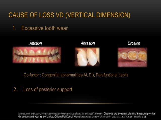 Diagnosis and treatment of choice in restoring vertical dimension